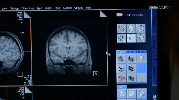 Is your Brain Male or Female (Horizon)